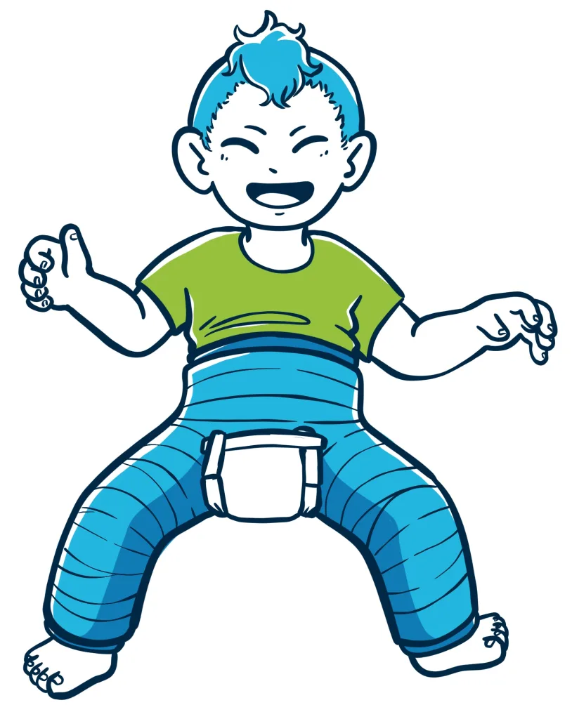 Spica Casts - Luskin Orthopaedic Institute for Children